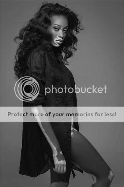 Winnie Harlow | the Fashion Spot